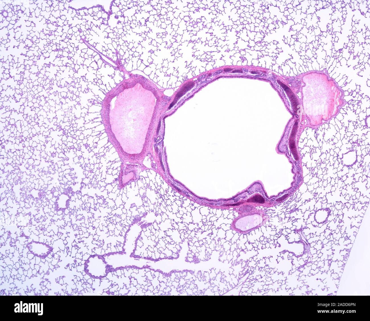 Very low magnification light micrograph of lung parenchyma. In the ...