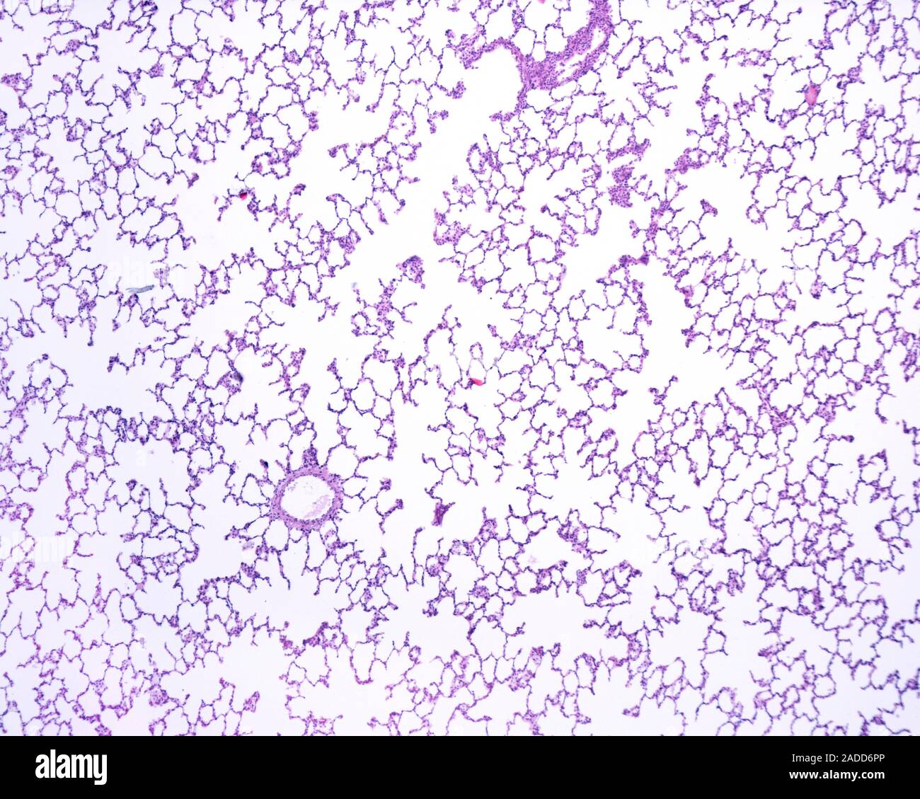 Very low magnification light micrograph showing the typical fine lace ...