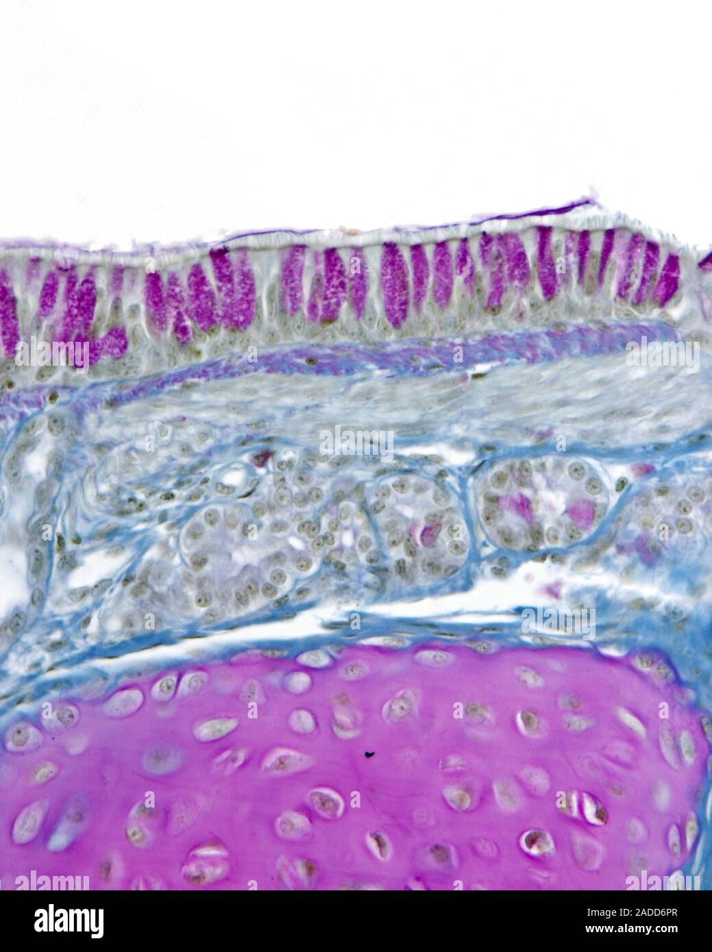 Light micrograph showing the distinctive elements of the bronchus wall ...