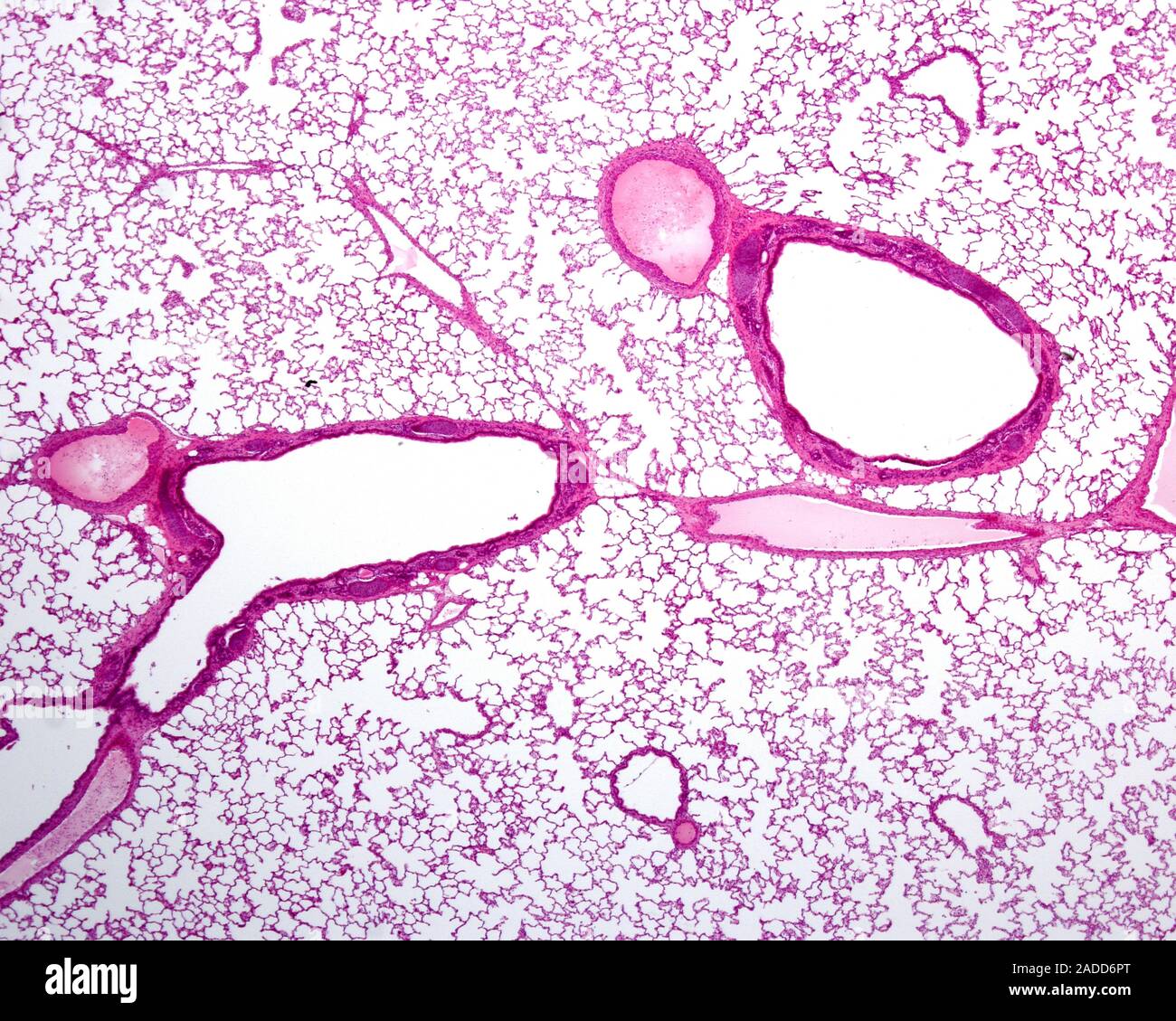 Very low magnification light micrograph of lung parenchyma showing two ...