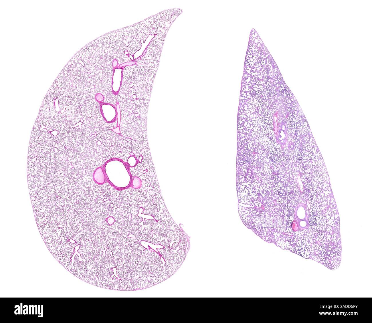 Collapsed and expanded lung, light micrograph. Comparison of a ...