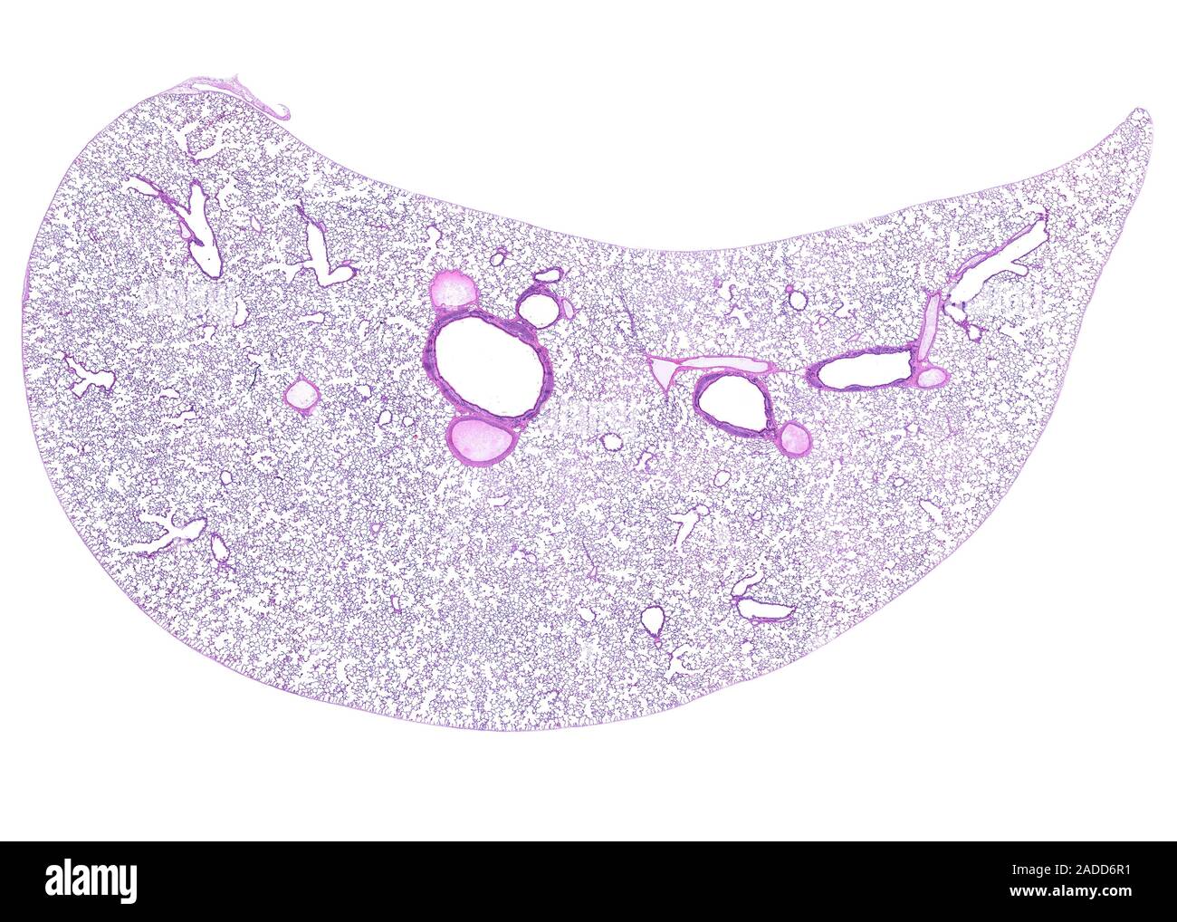 Very low magnification of an expanded lung. This is the appearance of ...