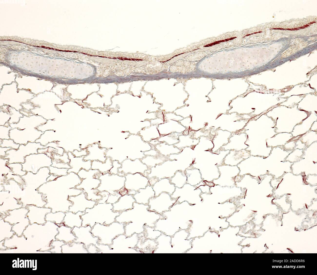 Light micrograph of well-defined secondary lobes delimited by septa in ...