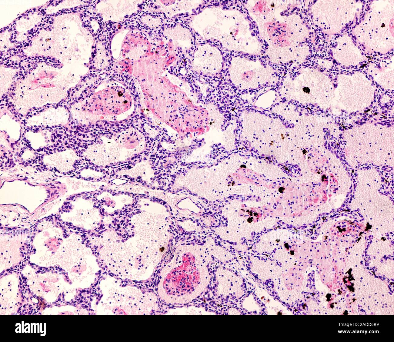 Light micrograph of a lung section showing the layer of elastic fibres ...