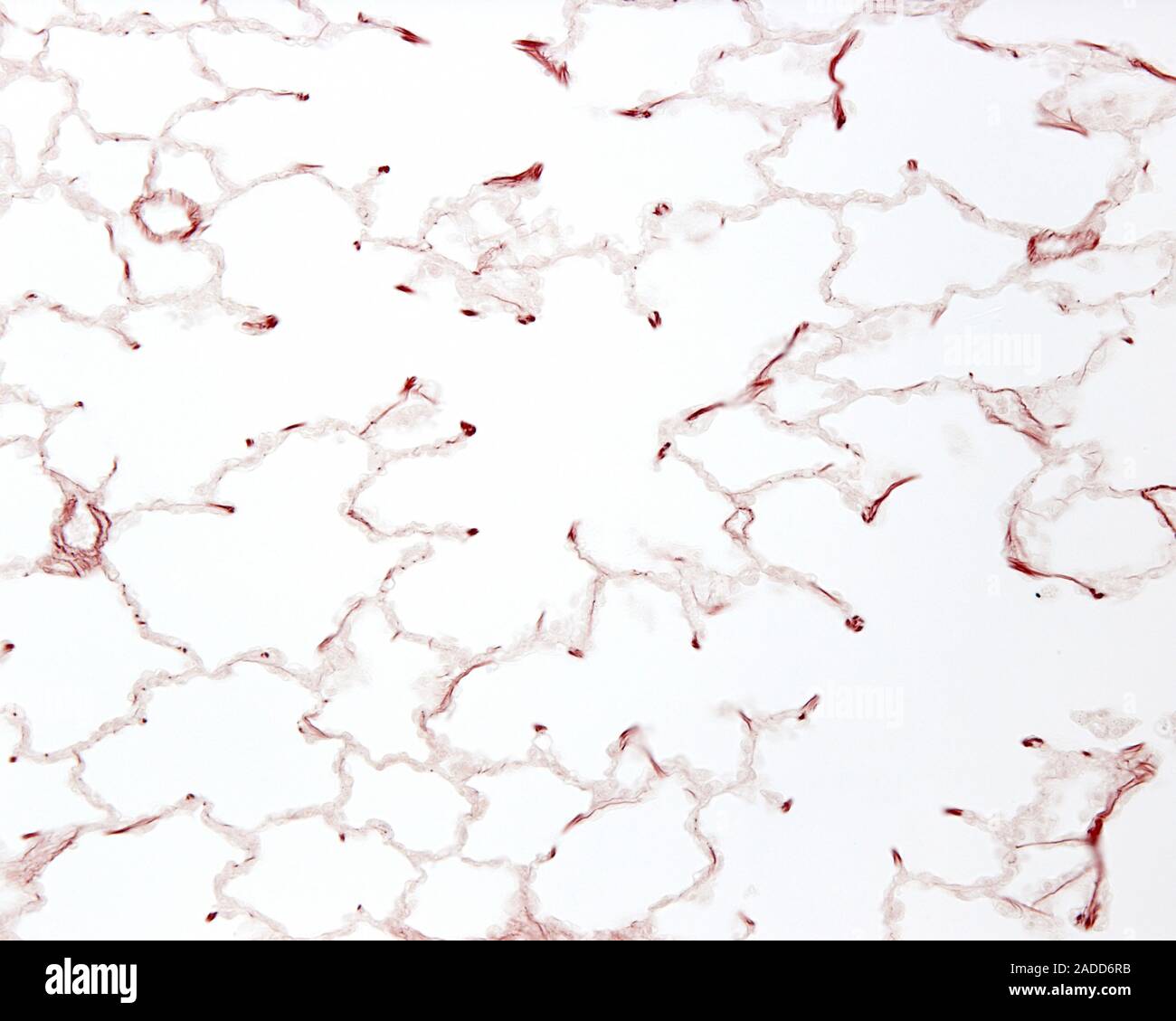 Light micrograph of a lung section showing the layer of elastic fibres ...