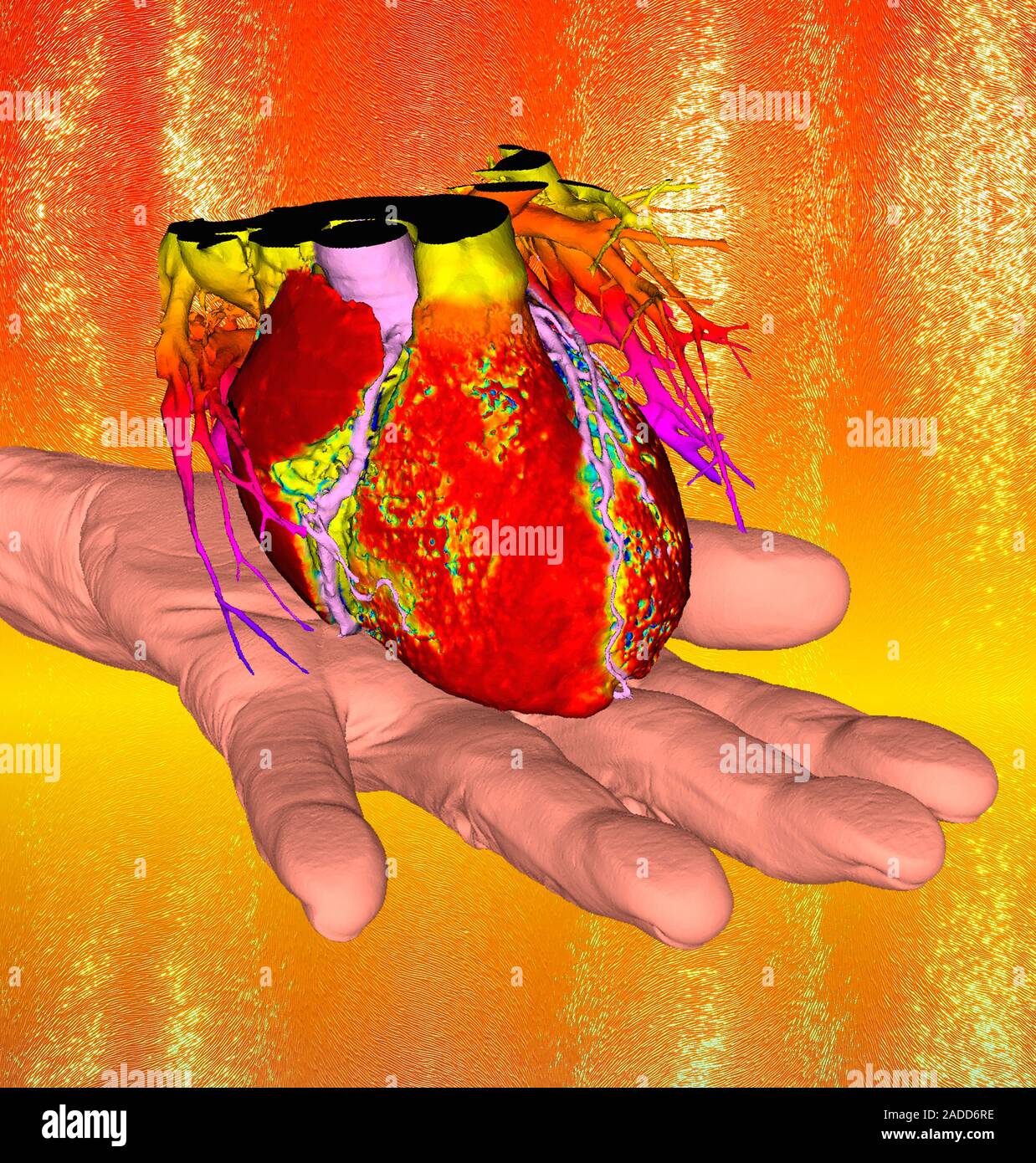 Human heart and hand, 3D coloured computed tomography (CT) angiogram ...