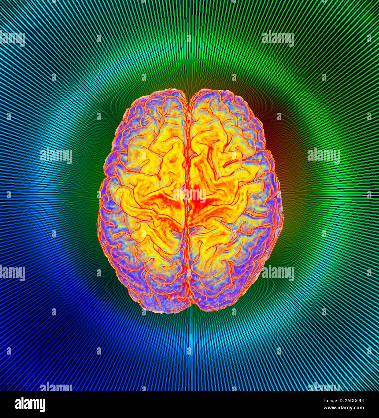 Human brain and abstract background, coloured 3D magnetic resonance imaging (MRI) scan. The ...