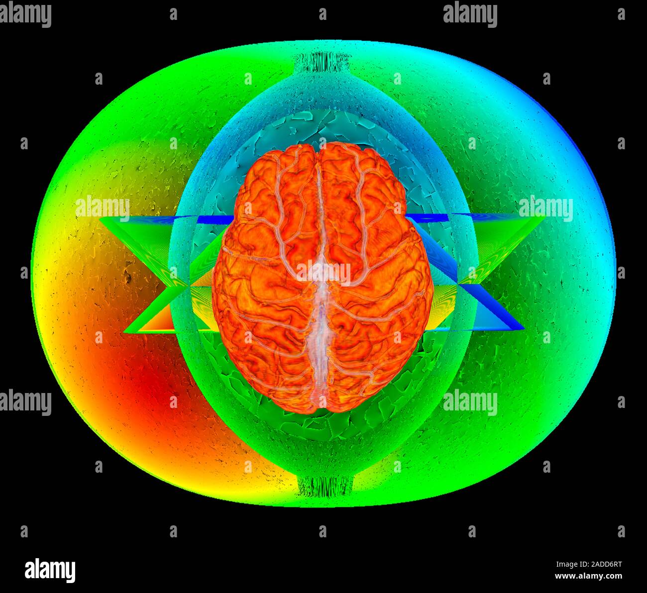 Human brain and abstract background, coloured 3D magnetic resonance imaging (MRI) scan. The ...