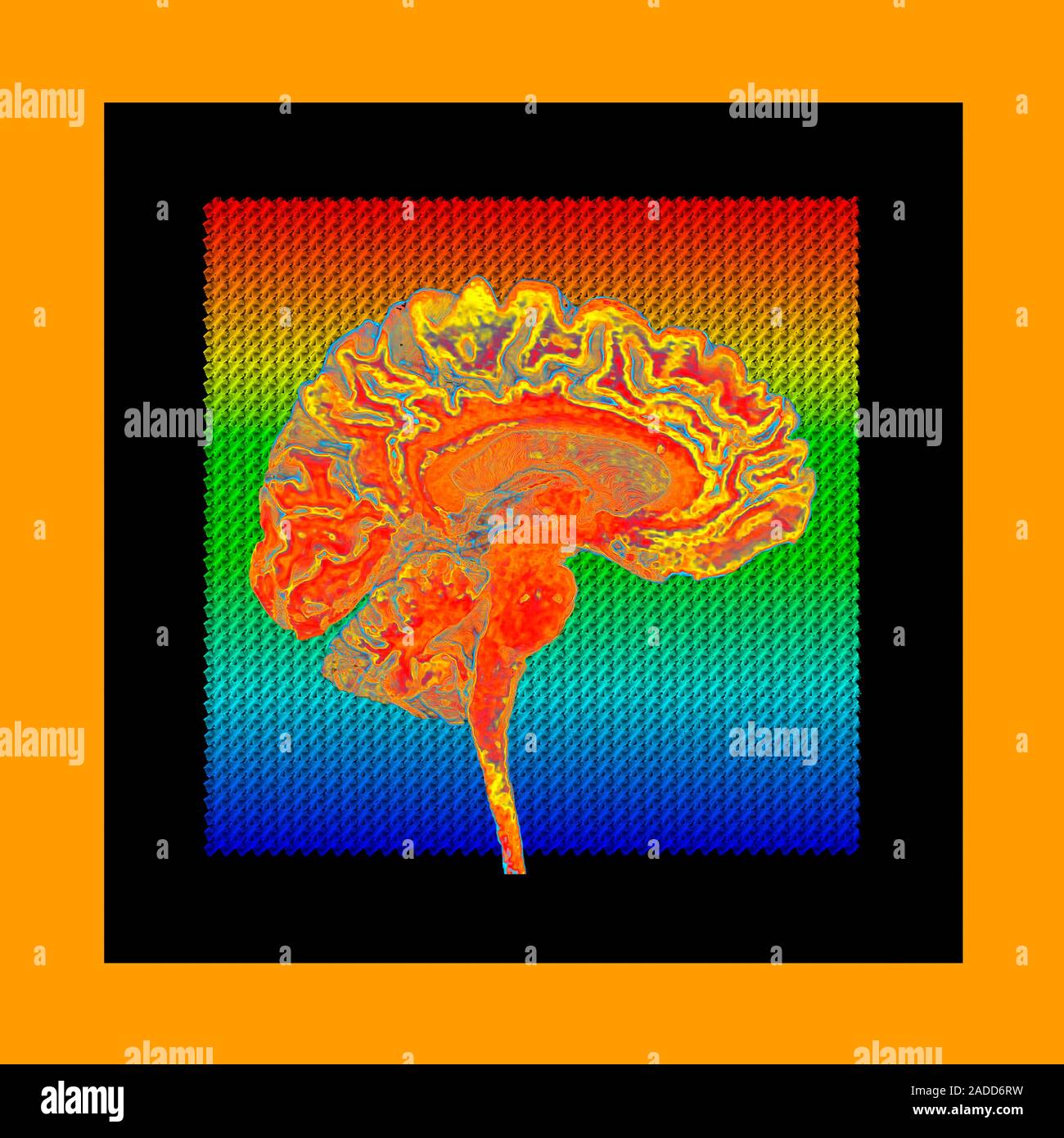Human brain abstract. Coloured sagittal magnetic resonance imaging (MRI ...