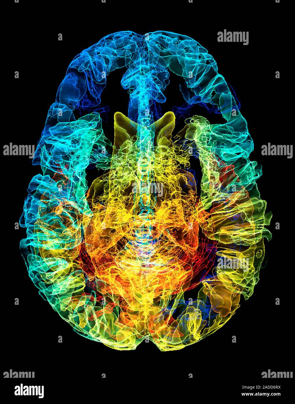 Human brain, coloured 3D magnetic resonance imaging (MRI) scan. This view from above shows the ...