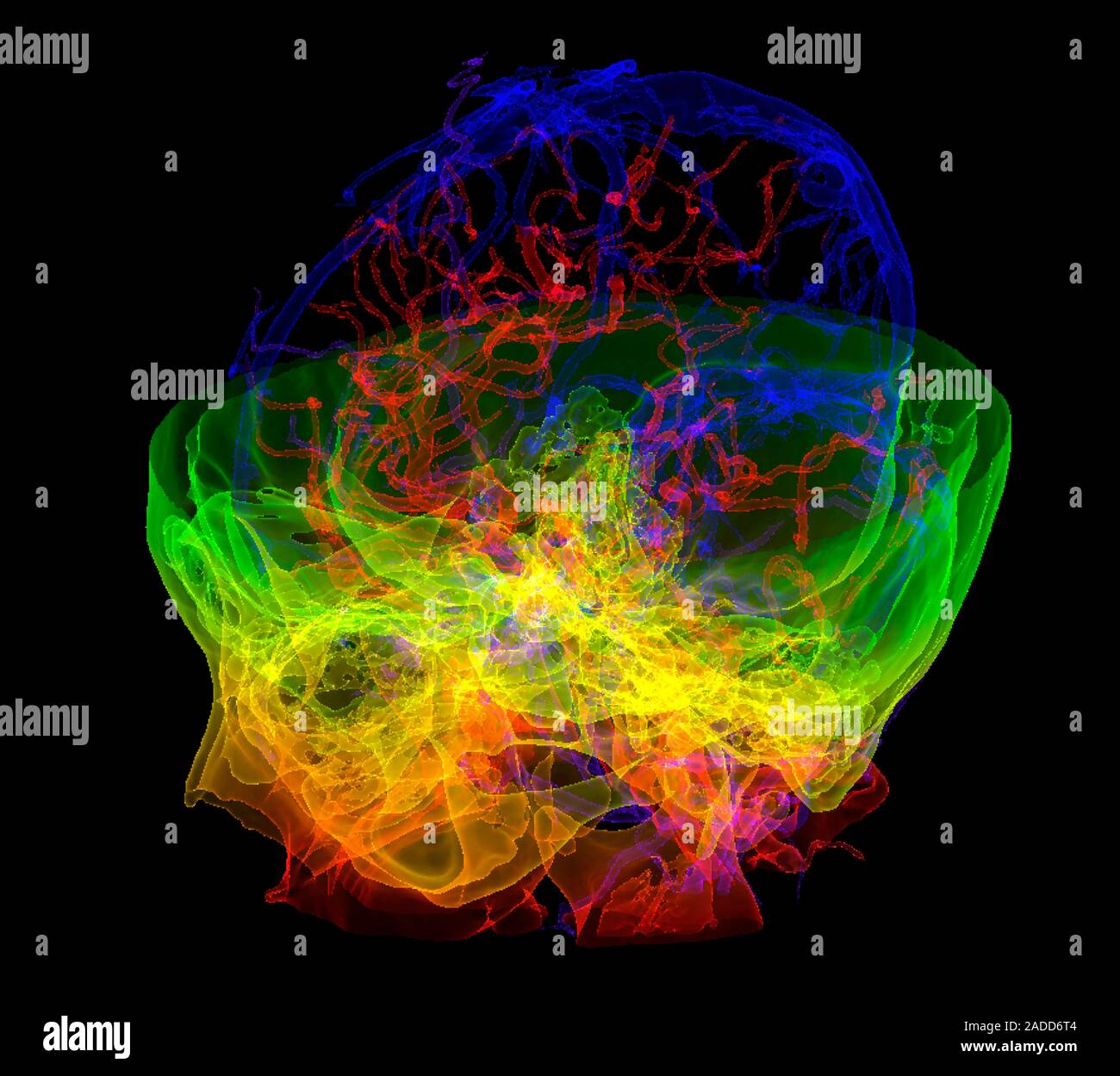 Brain blood vessels. Coloured 3D computed tomography (CT) angiogram, showing the arteries (red ...