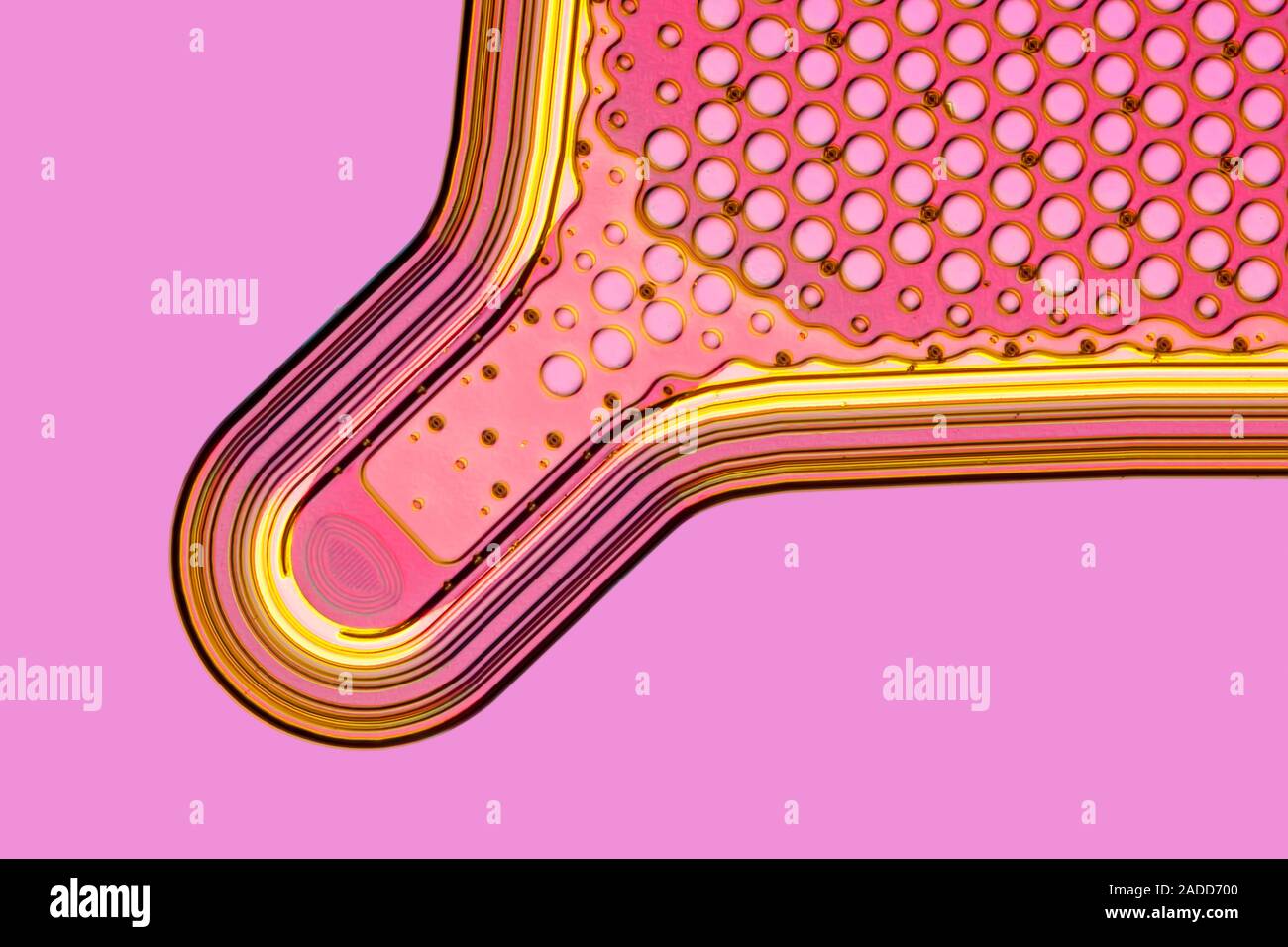 Light micrograph of a MEMS (MicroElectroMechanical System) microphone ...