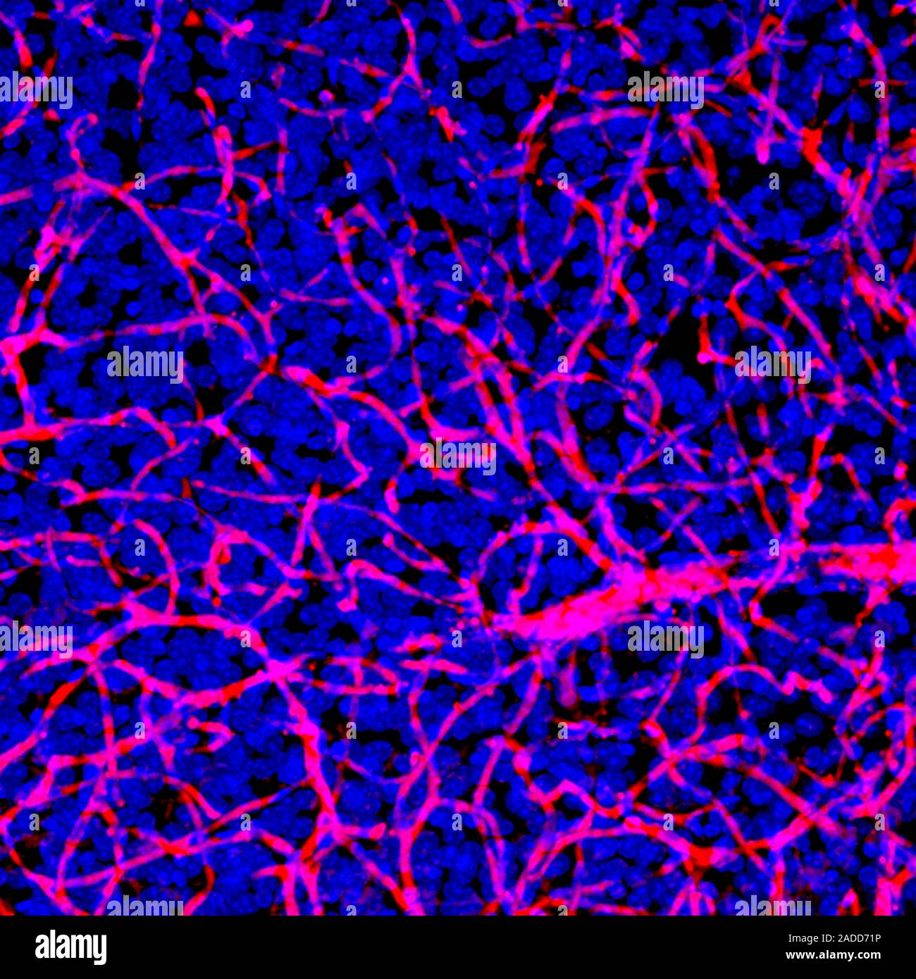 Blood-brain barrier. Fluorescence light micrograph of the dense network ...
