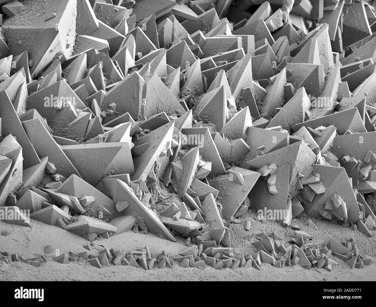 Kidney stone surface, scanning electron micrograph (SEM). Kidney stones ...