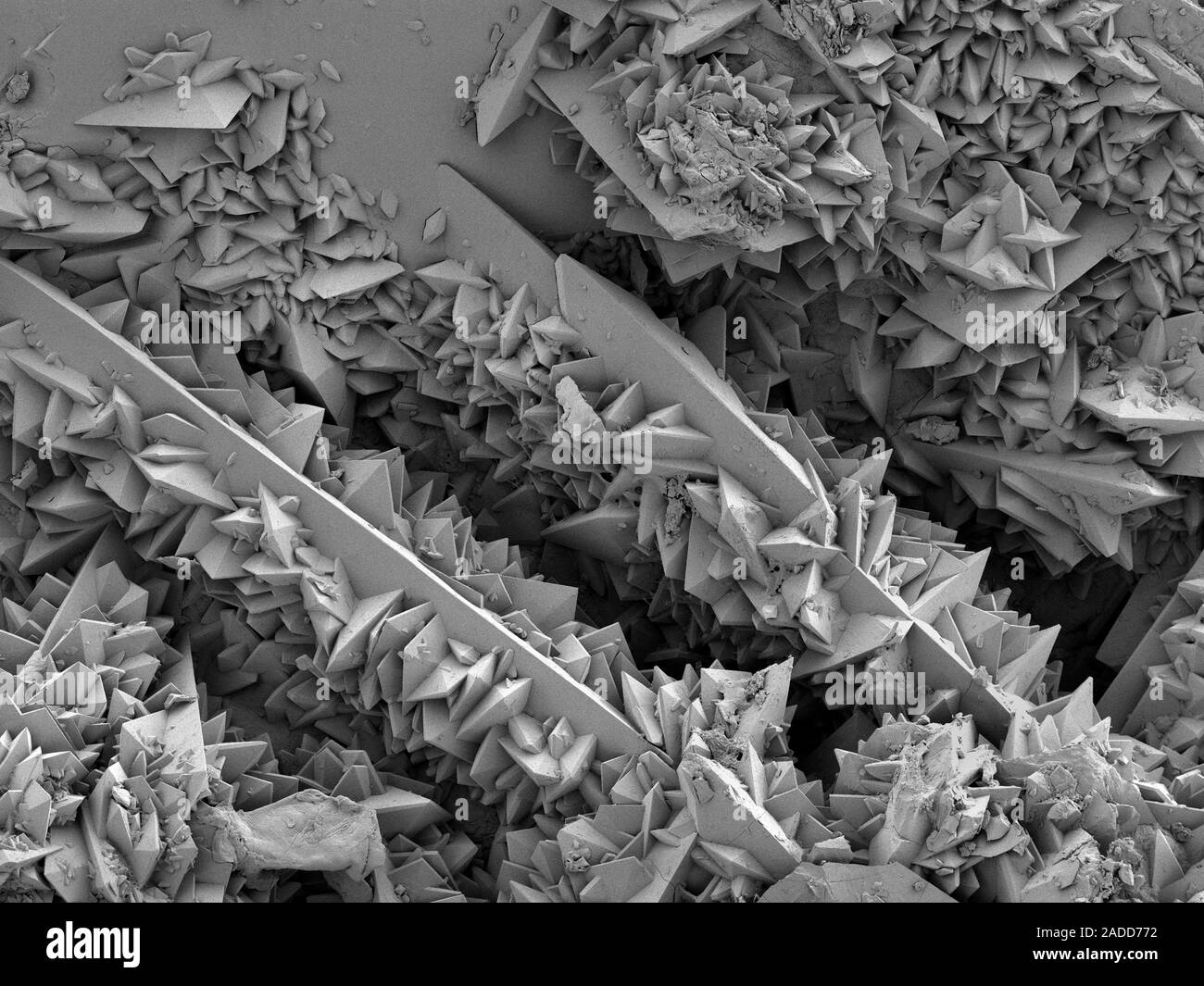 Kidney stone surface, scanning electron micrograph (SEM). Kidney stones ...