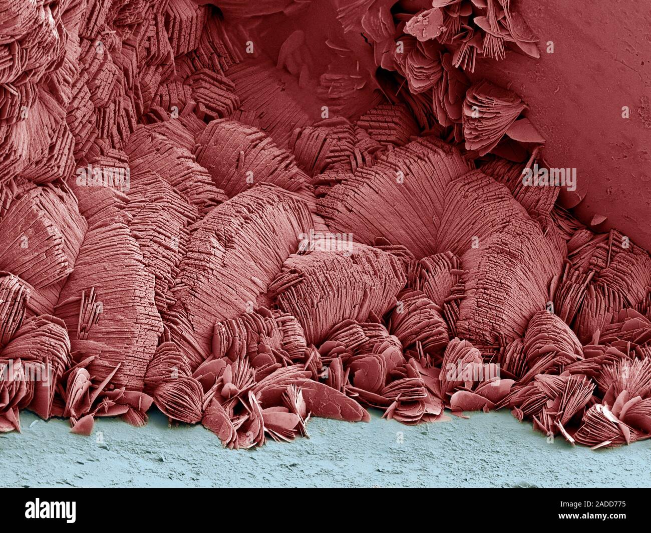 Kidney stone surface, coloured scanning electron micrograph (SEM ...