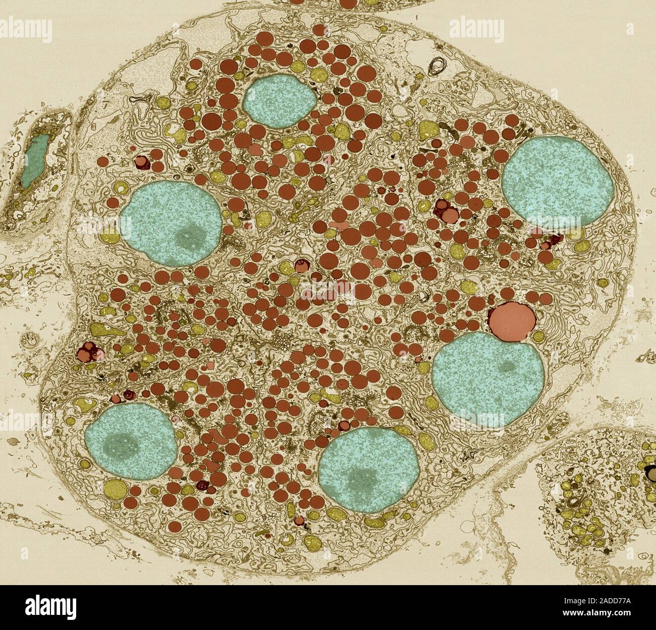 Pancreatic acinar cells, coloured transmission electron micrograph (TEM ... Pancreatic acinar cells, coloured transmission electron micrograph (TEM ...