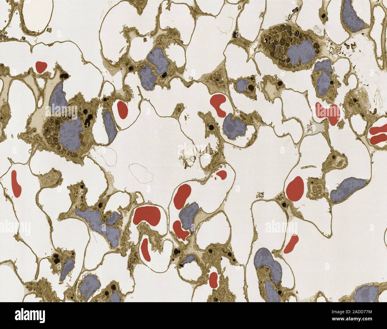 Lung alveoli and red blood cells. Coloured transmission electron ...