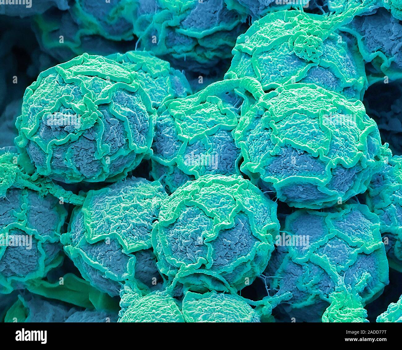 Botryococcus alga. Coloured scanning electron micrograph (SEM) of ...