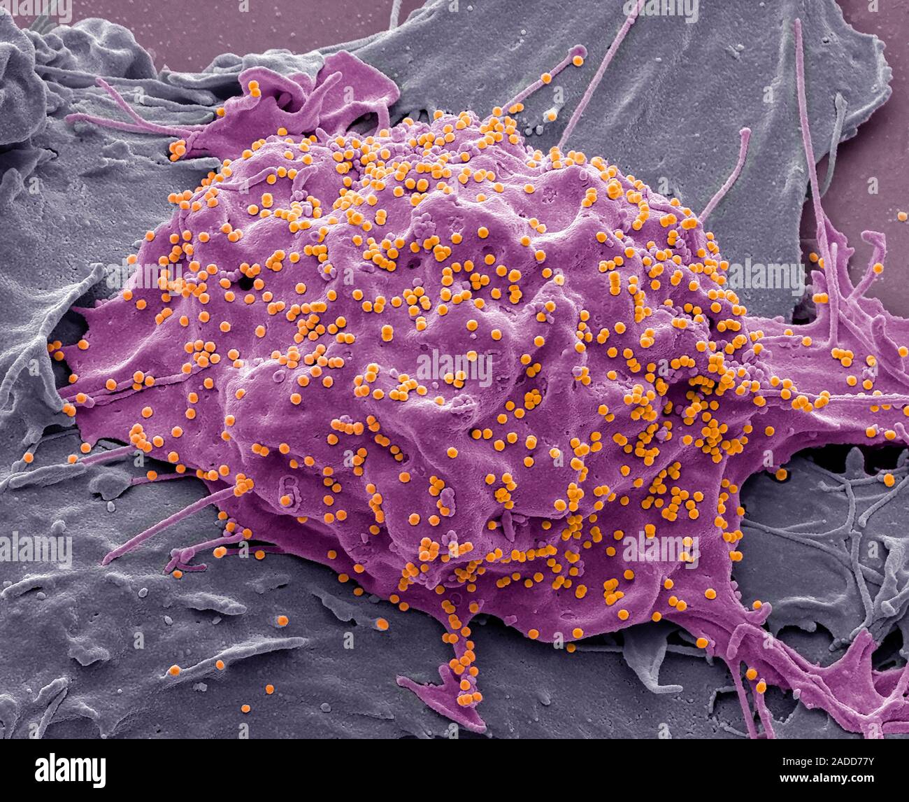 Human cells infected with Simian Immunodeficiency Virus from sooty ...