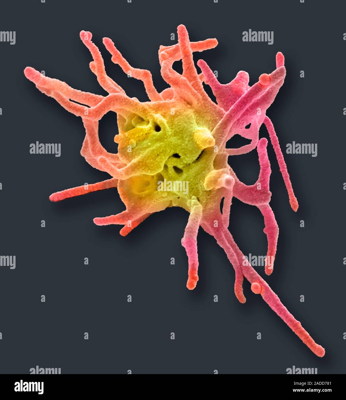 Activated platelet. Coloured scanning electron micrograph (SEM) of an activated platelet from a ...
