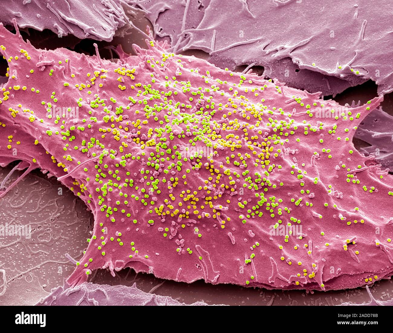 Human cells infected with Simian Immunodeficiency Virus from sooty ...