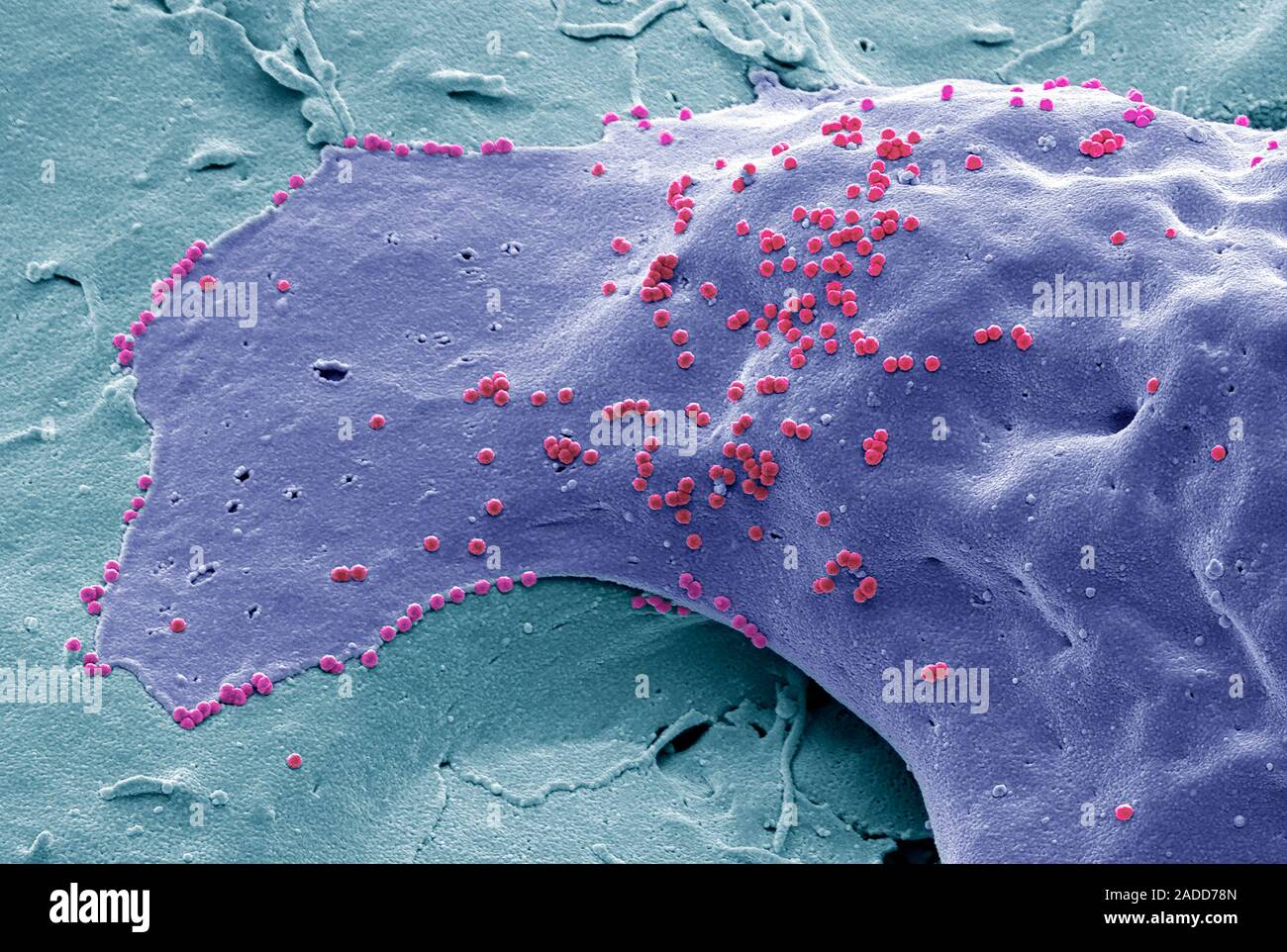 HIV viral vector. Scanning electron micrograph (SEM) of viral vectors ...