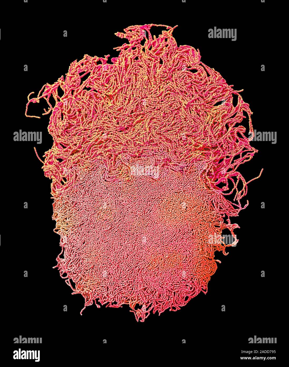 Sputum. Scanning electron micrograph (SEM) of a bacterial culture from ...