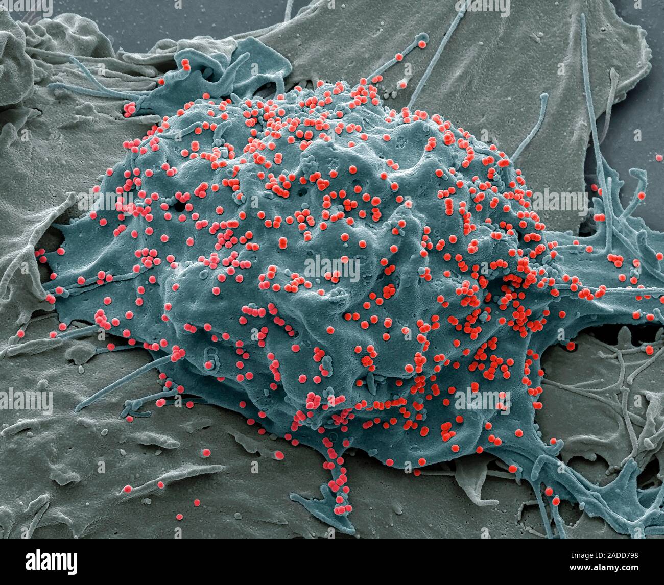 Human cells infected with Simian Immunodeficiency Virus from sooty ...