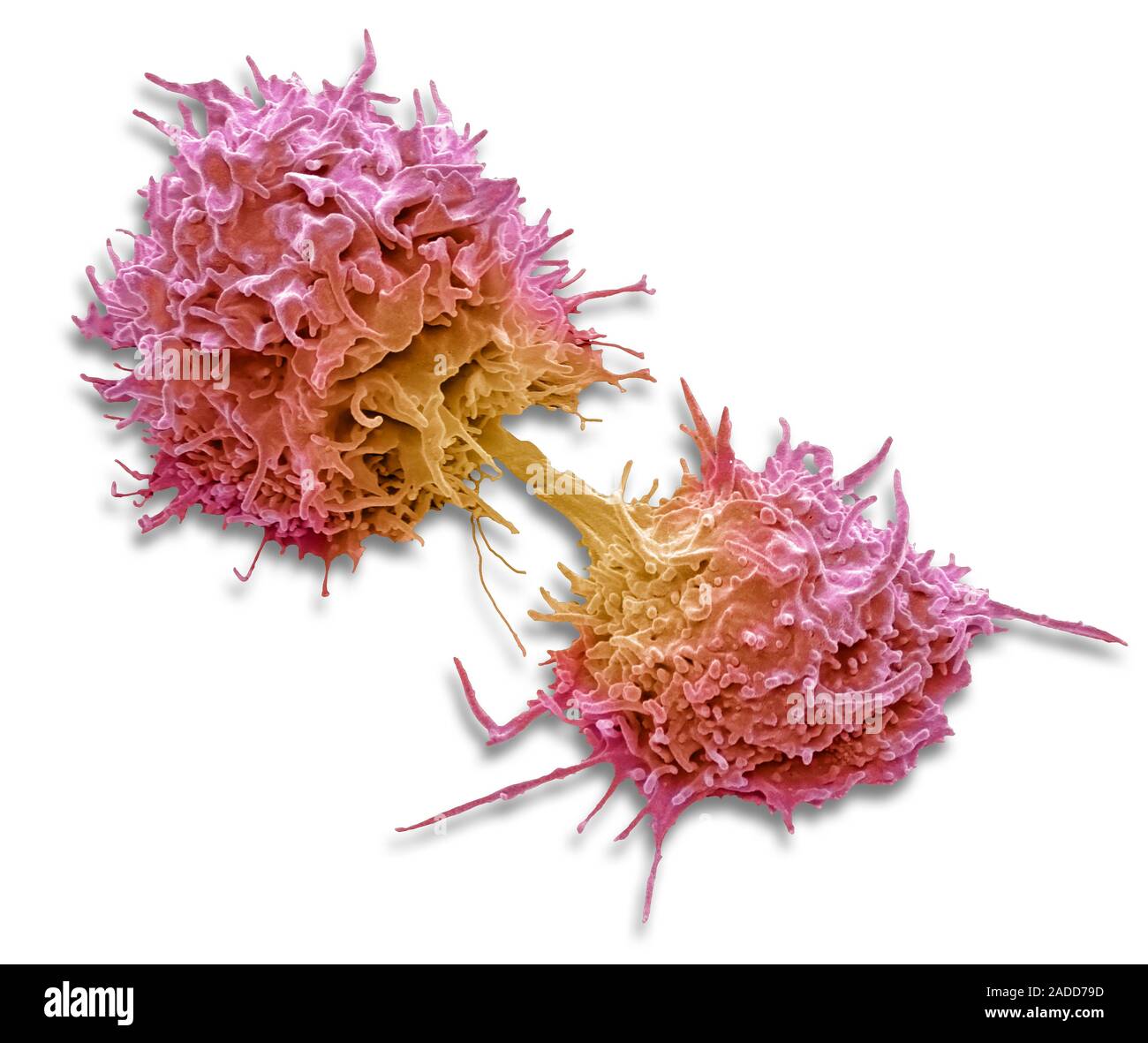 Dividing T lymphocytes, coloured scanning electron micrograph (SEM) of ...