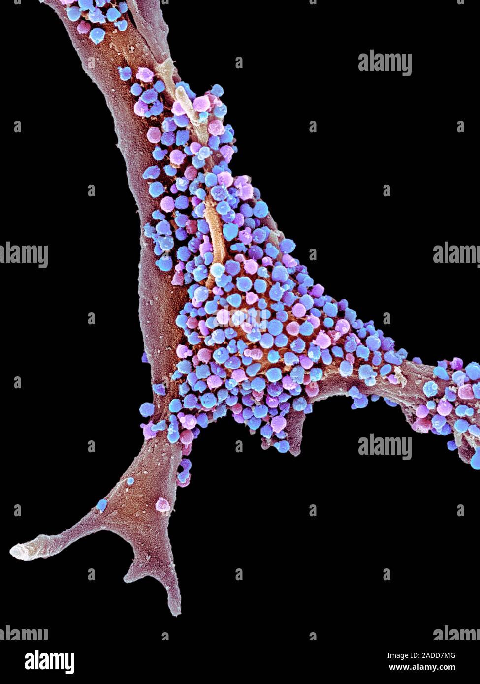 Cell infected with herpes virus. Coloured scanning electron micrograph ...