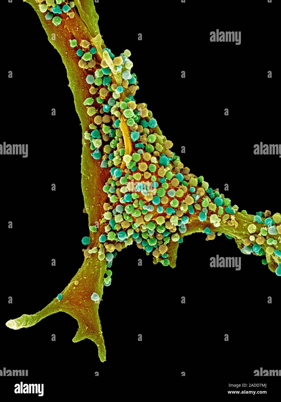 Cell infected with herpes virus. Coloured scanning electron micrograph ...