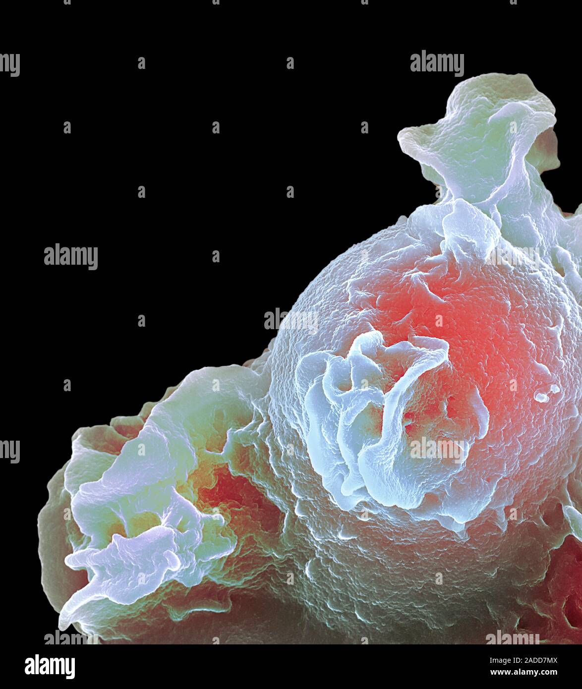 Coloured scanning electron micrograph (SEM) of a neutrophil white blood ...