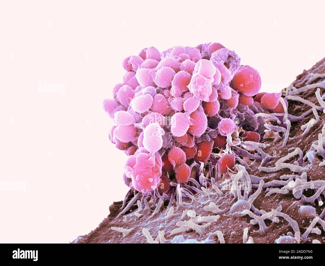 Gonorrhoea Bacteria Coloured Scanning Electron Micrograph Sem Of A Neisseria Gonorrhoeae