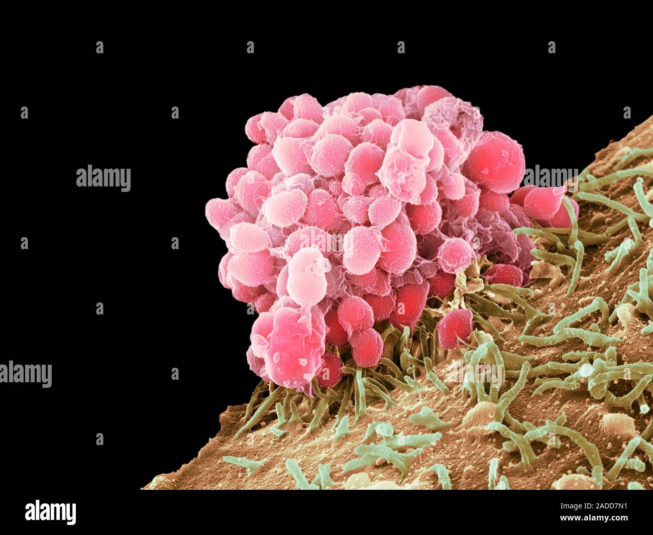 Gonorrhoea bacteria. Coloured scanning electron micrograph (SEM) of a ...