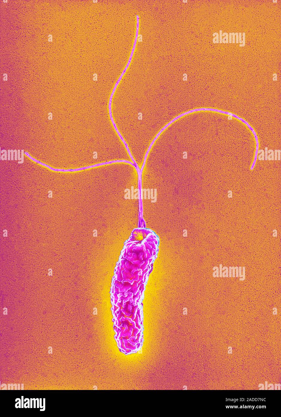 Helicobacter pylori bacterium, coloured scanning electron micrograph (SEM). H. pylori is a Gram ...
