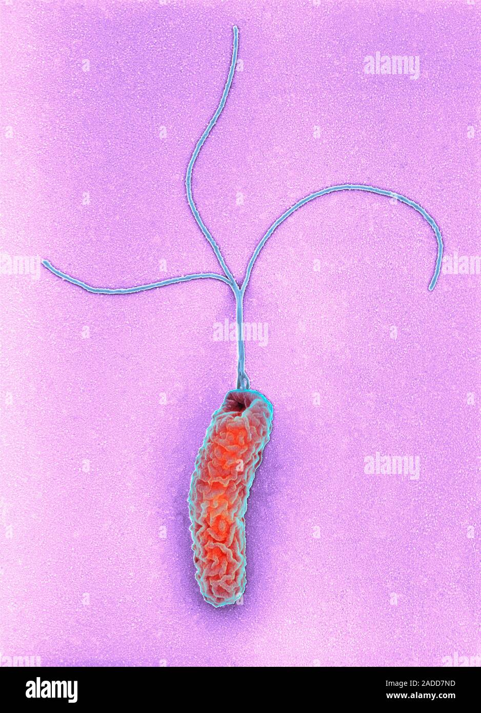 Helicobacter pylori bacterium, coloured scanning electron micrograph ...