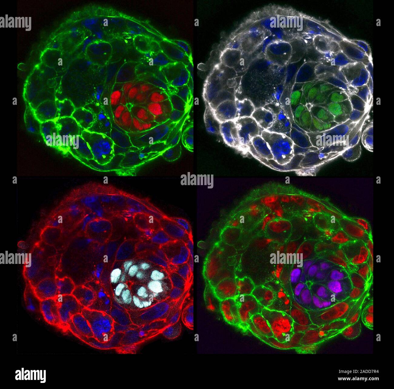 Immunofluorescence light micrograph of four human embryos 10 days after ...