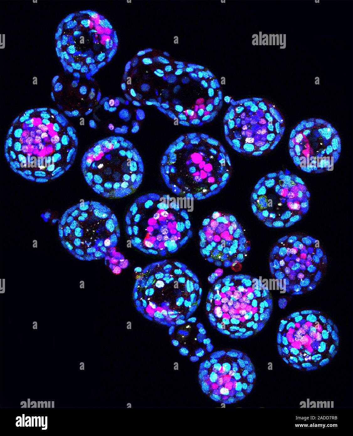 Mouse blastocysts, confocal micrograph. A blastocyst is a hollow ball ...