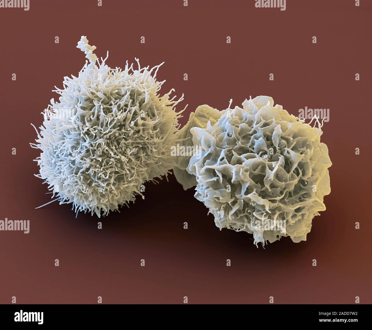 Dendritic cells, coloured scanning electron micrograph (SEM). These ...