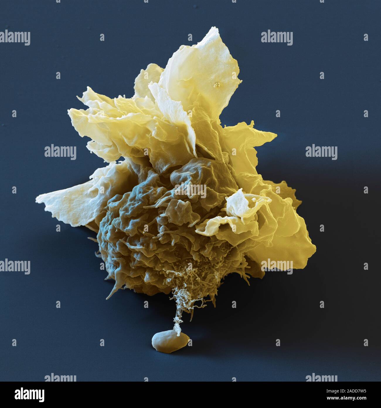 Dendritic cell, coloured scanning electron micrograph (SEM). This cell ...