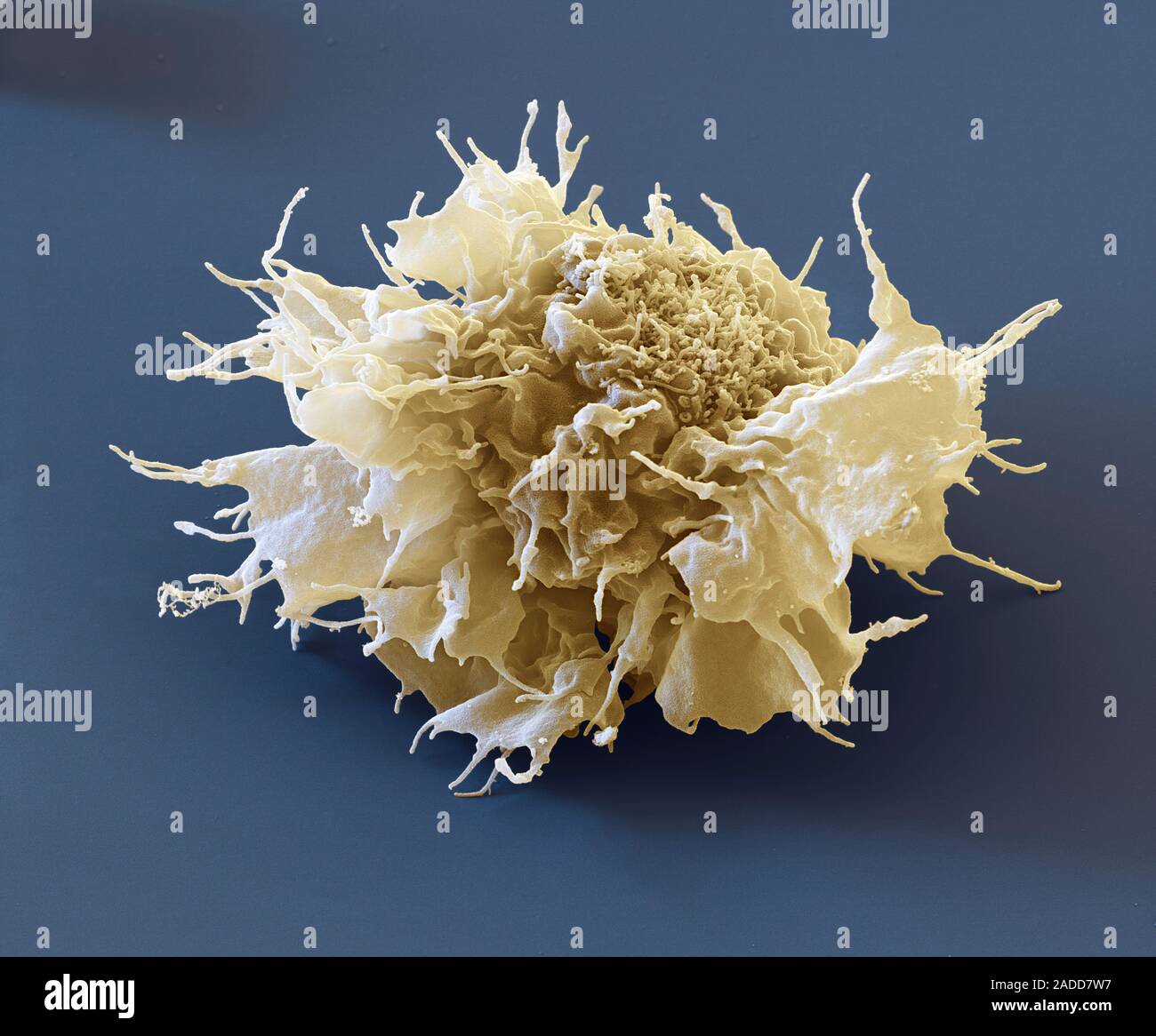 Dendritic cell, coloured scanning electron micrograph (SEM). This cell ...