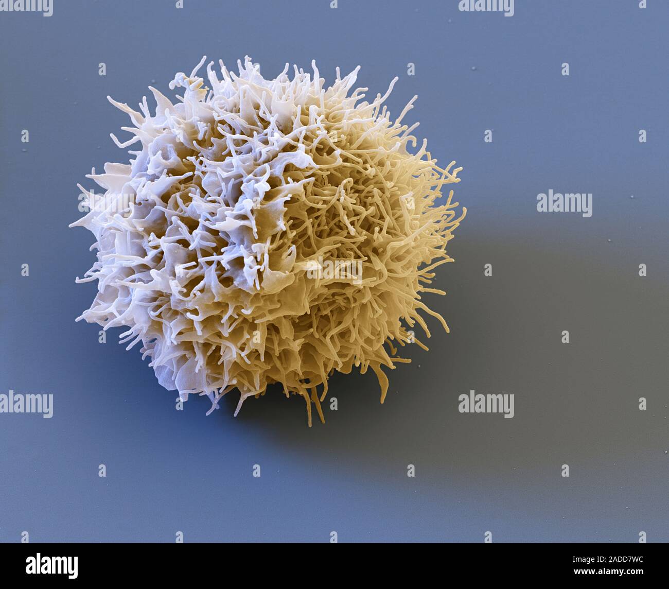Dendritic cell, coloured scanning electron micrograph (SEM). This cell ...