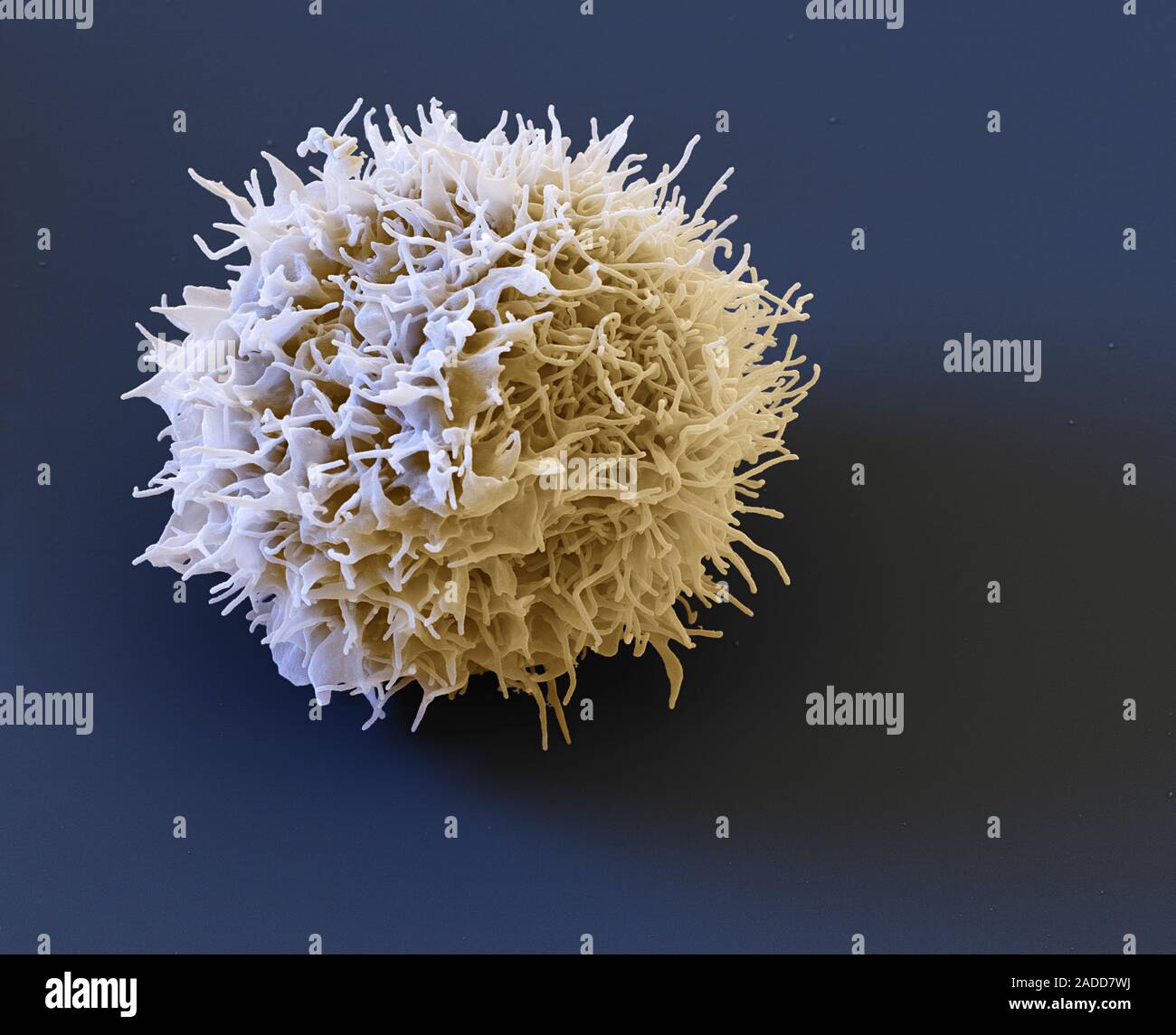 Dendritic cell, coloured scanning electron micrograph (SEM). This cell ...