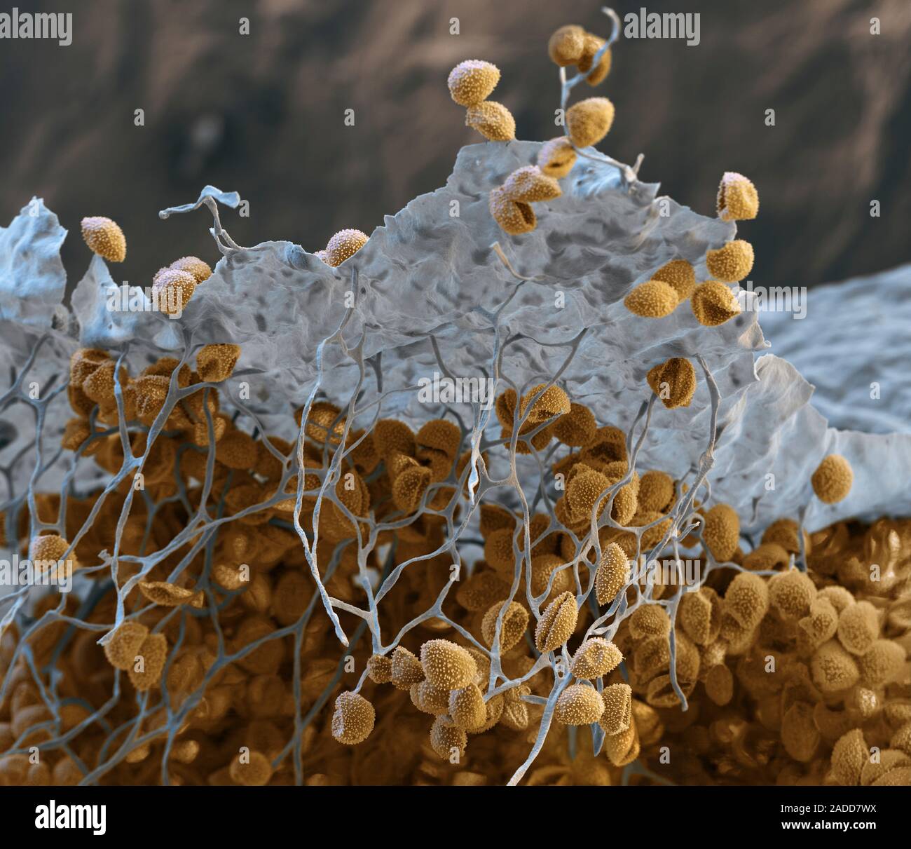 Slime mould spores. Coloured scanning electron micrograph (SEM) of ...