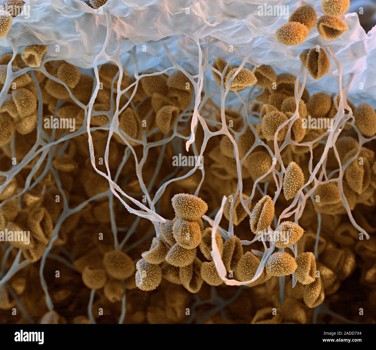 Slime mould spores. Coloured scanning electron micrograph (SEM) of ...