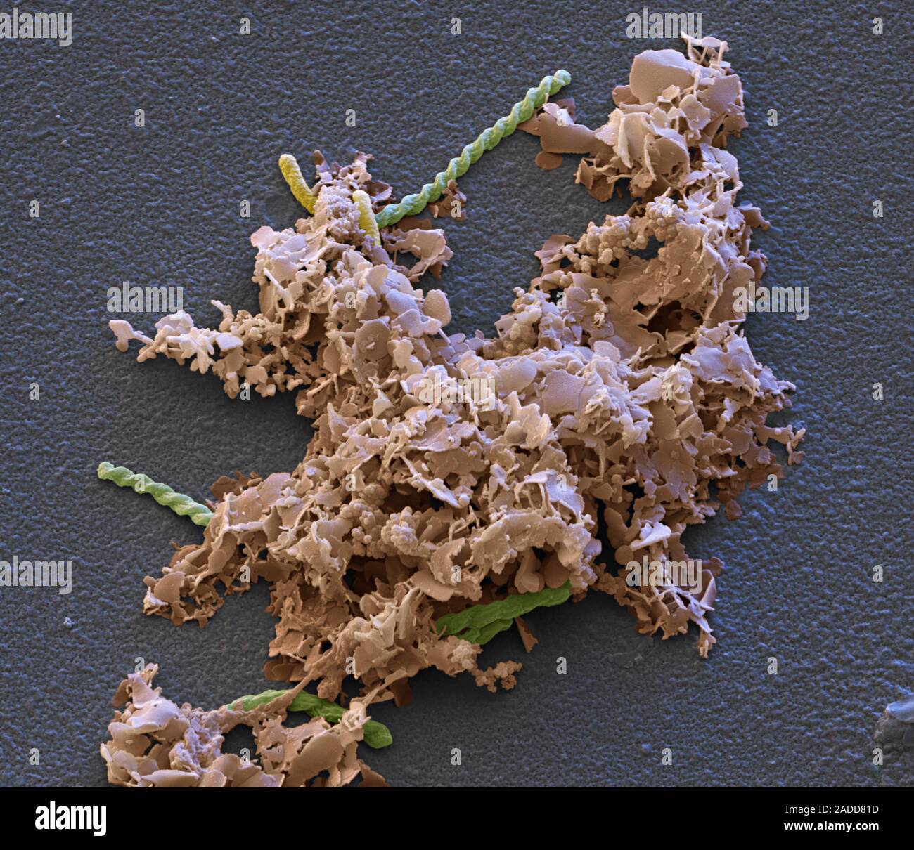 Iron-oxidizing soil bacterial culture. Coloured scanning electron ...