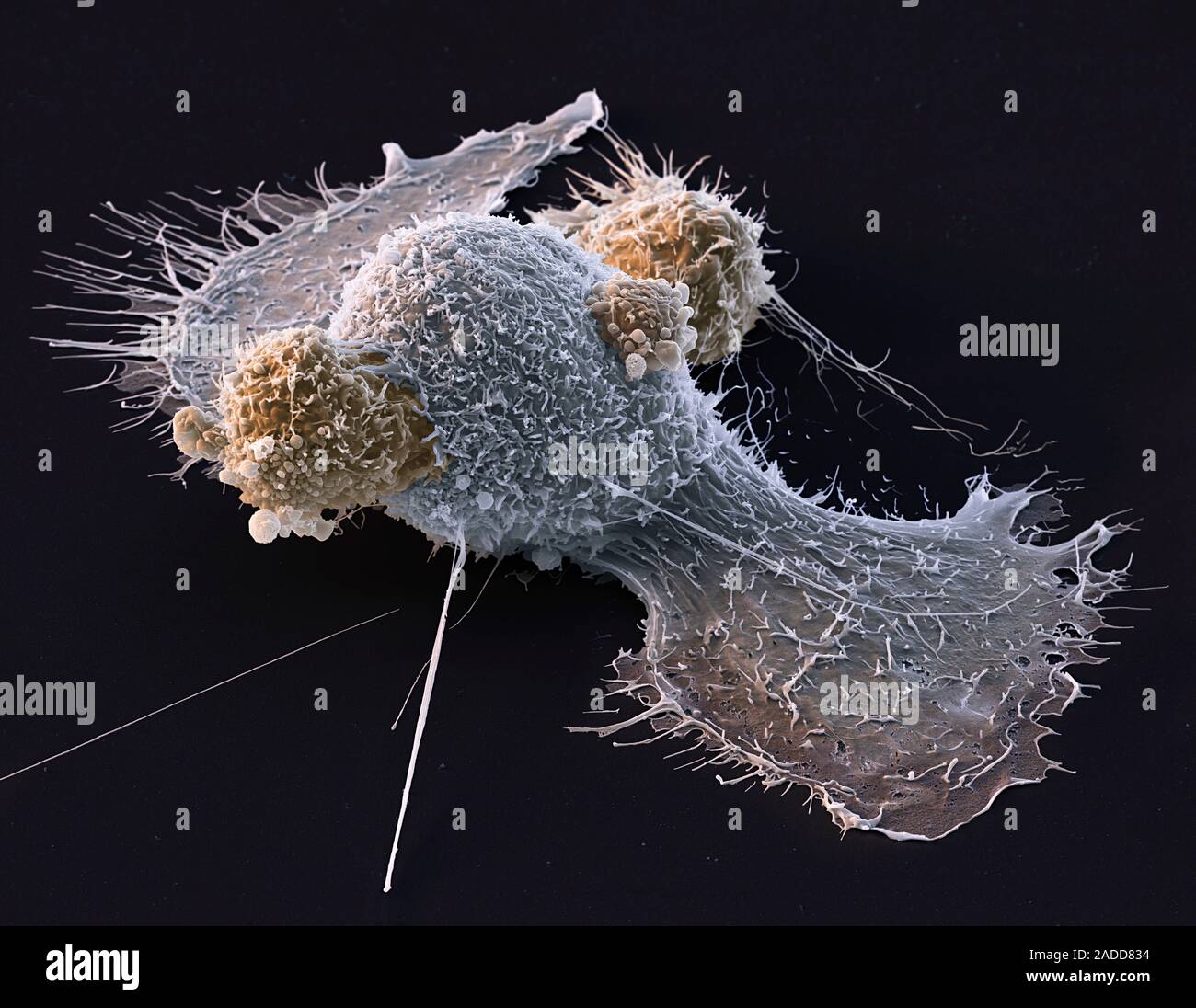 Macrophage and T helper cells. Coloured scanning electron micrograph (SEM) of a macrophage cell ...