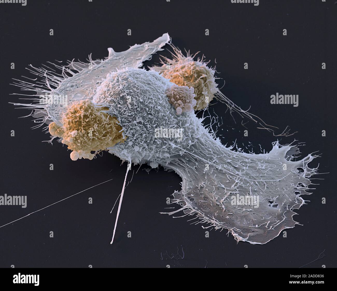 Macrophage and T helper cells. Coloured scanning electron micrograph ...