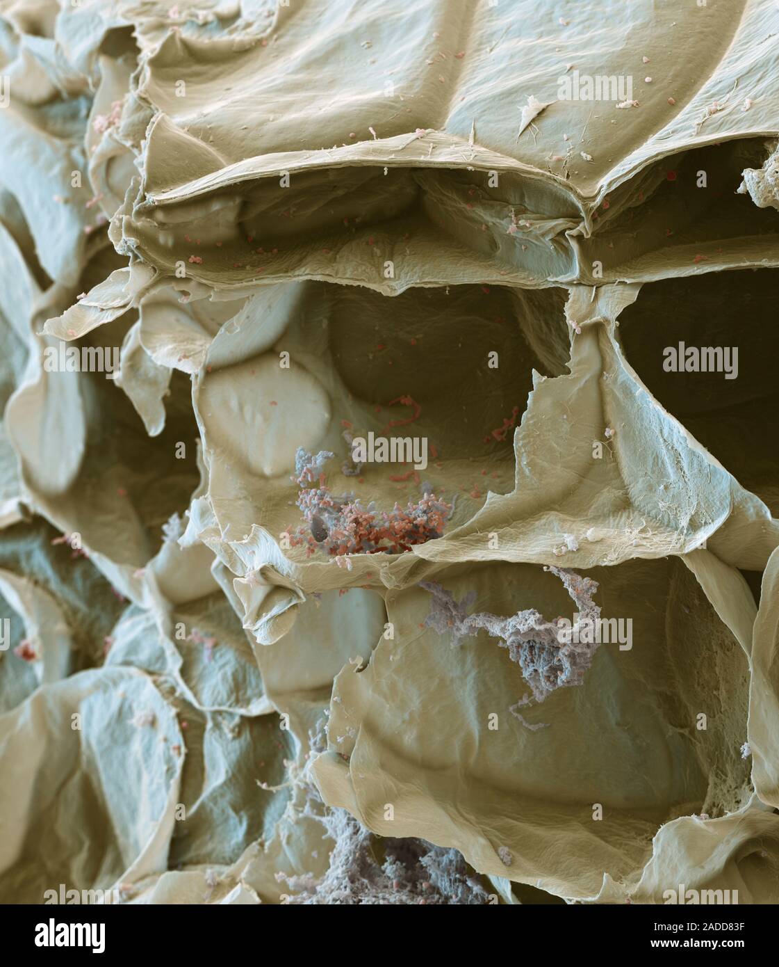 Bacteria on fermented cabbage, coloured scanning electron micrograph ...